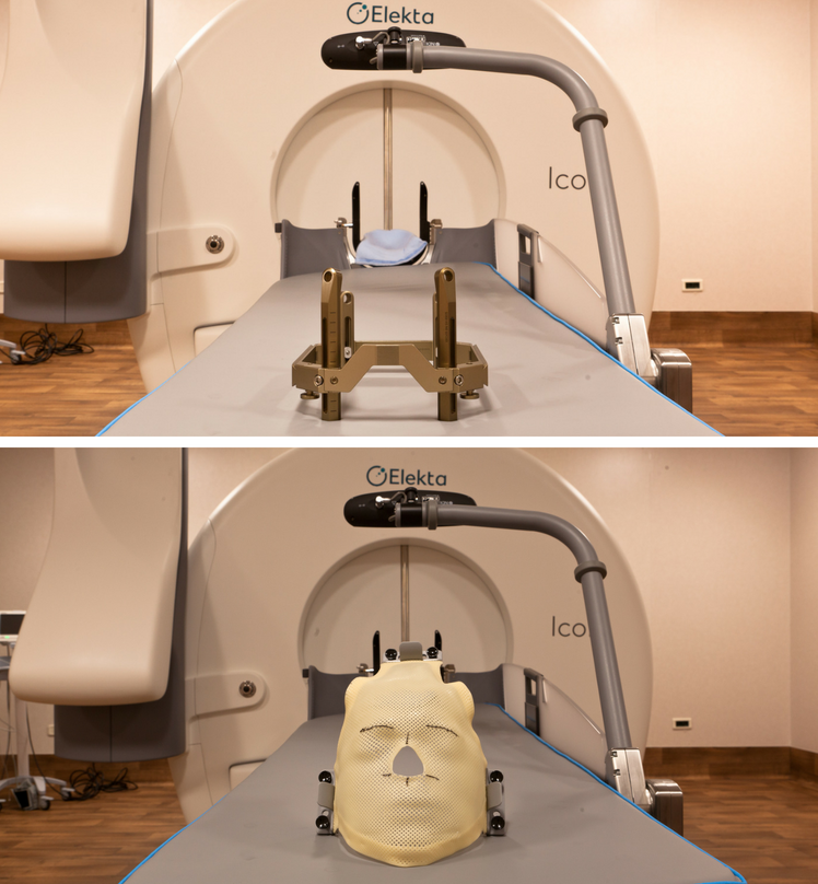 Gamma knife: scegliere tra casco stereotassico e maschera termoplastica